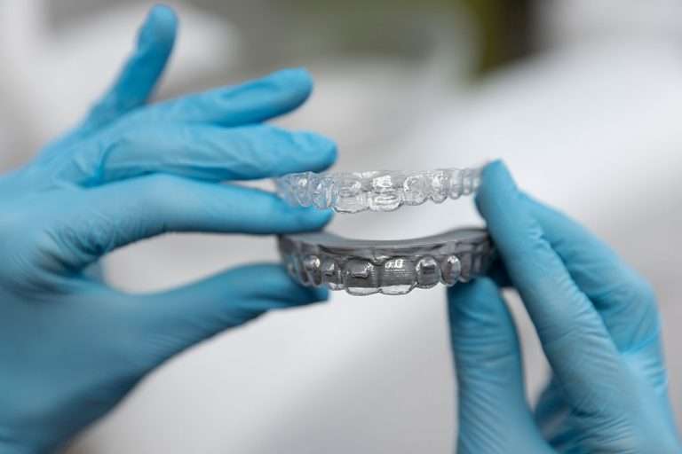 Dental Braces and Aligners - Rekha's Dental Clinic in Sharjah