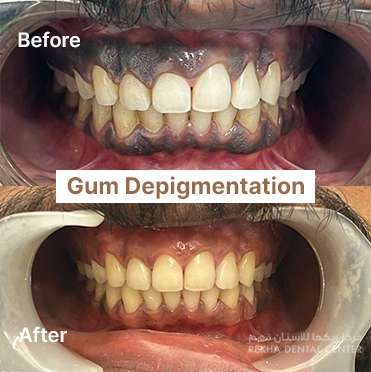 Rekha Dental Center – Rekha Dental Center